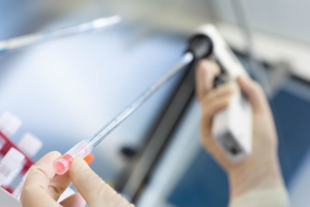 Cell Therapy Development and Manufacturing Services | AGC Biologics