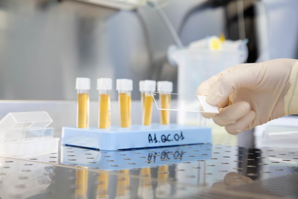 Process Validation: Quality Control & Clinical Supply | AGC Biologics